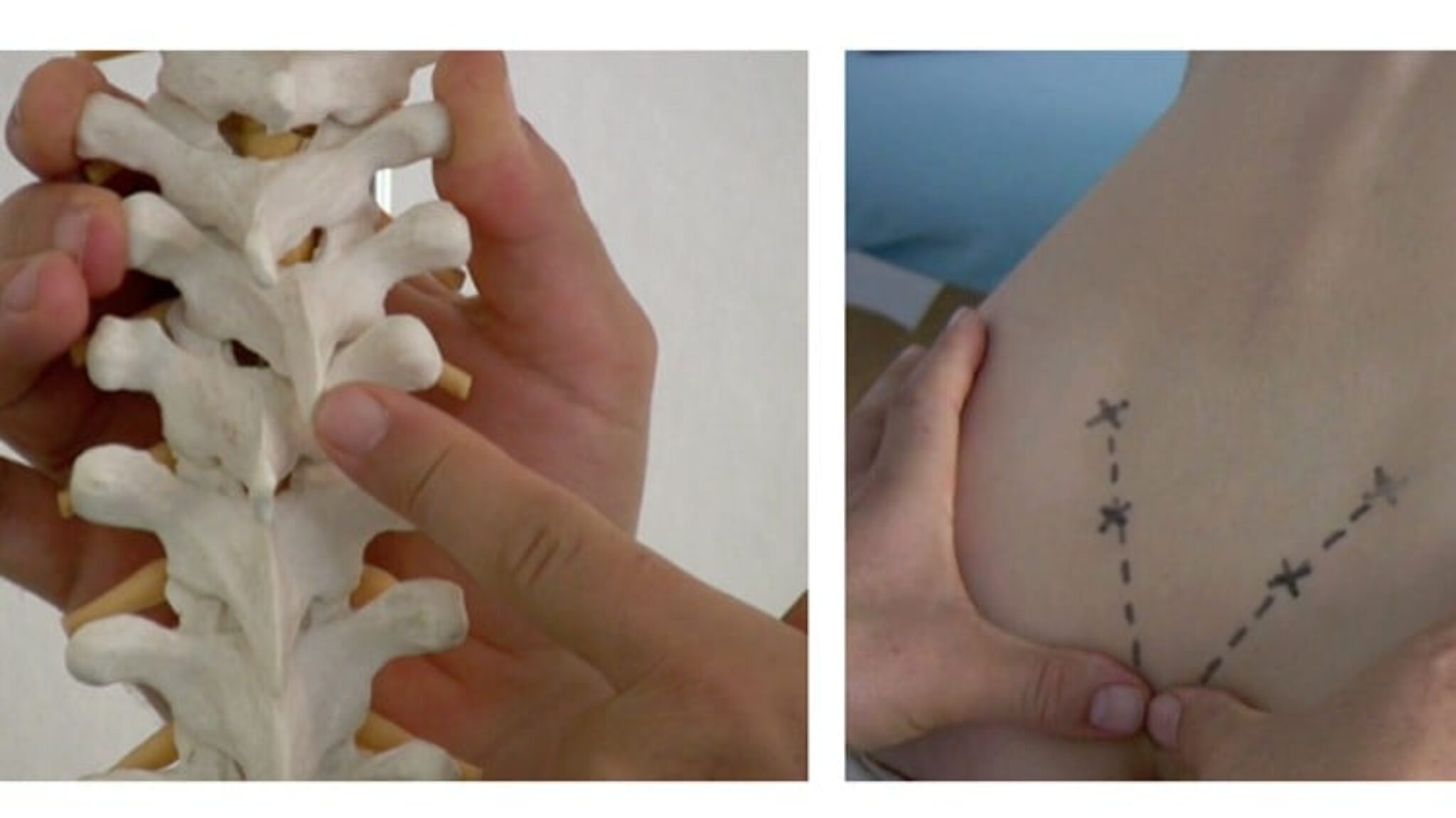 Spine healing with the DORN-Method - Preventing back pain! - Free ...
